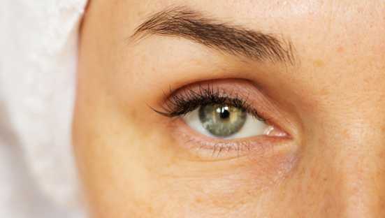 Traitements des cernes et des poches sous les yeux | Dr Cédric Kron