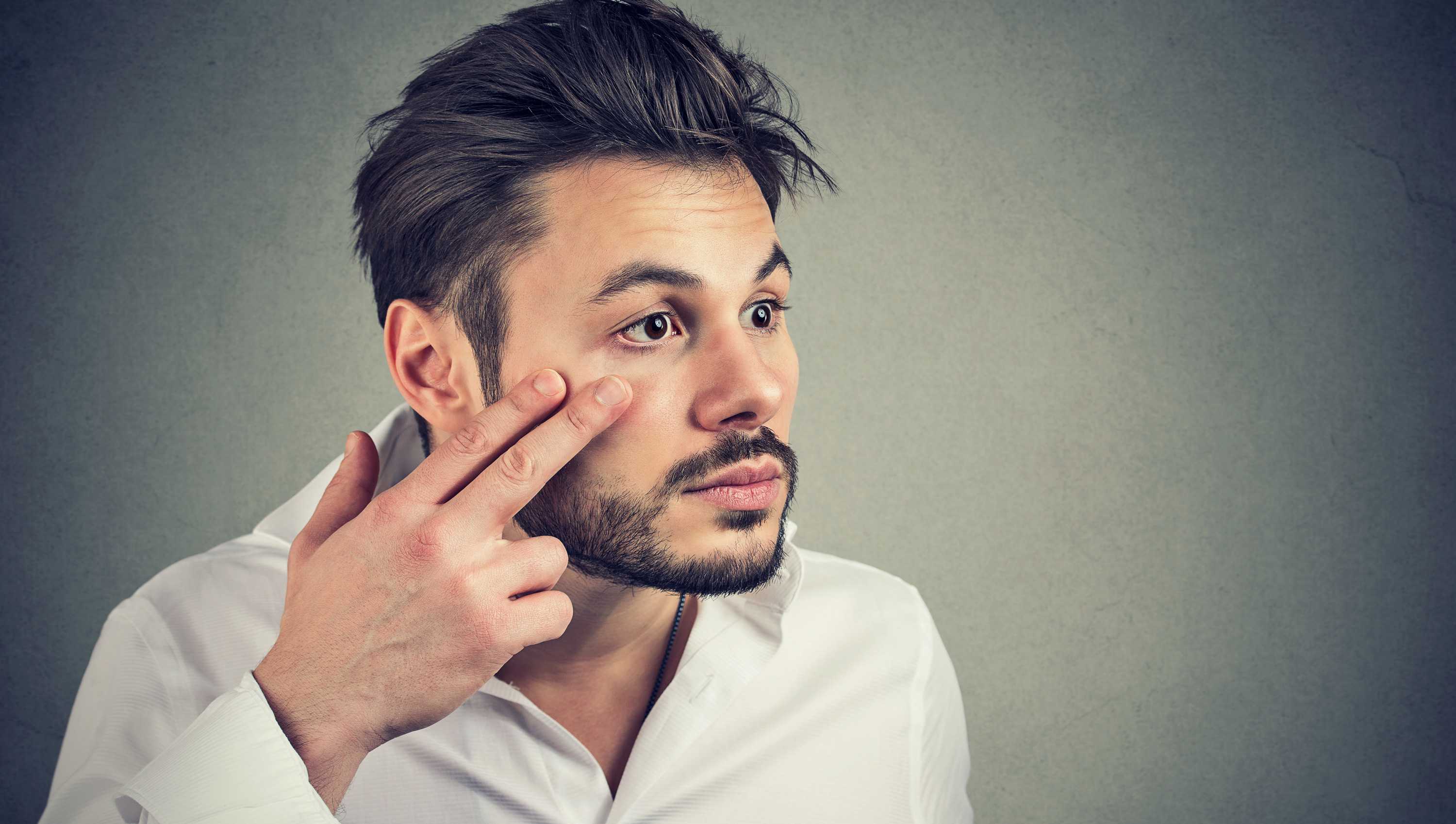 Comblement des cernes creux par acide hyaluronique | Dr Cédric Kron