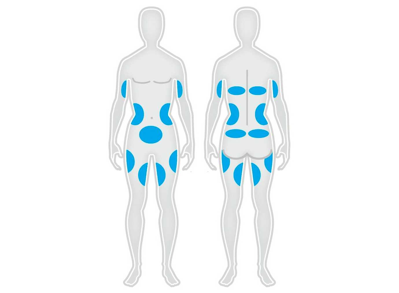 Cryolipolyse with Coolsculpting in Paris